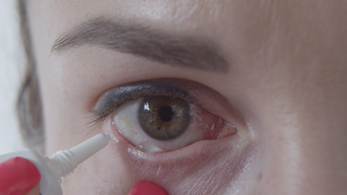 Glaucoma: cómo se ve la enfermedad